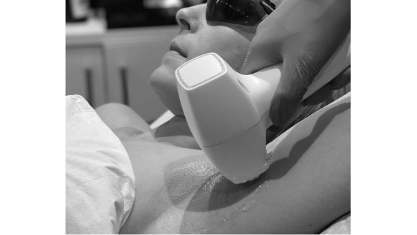 Waterloo, ON Full-Body Laser Hair Removal: Med Spa Consultations Announced