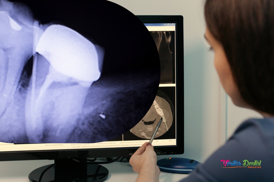 How to Properly Use Dental Code D4341: A Comprehensive Guide