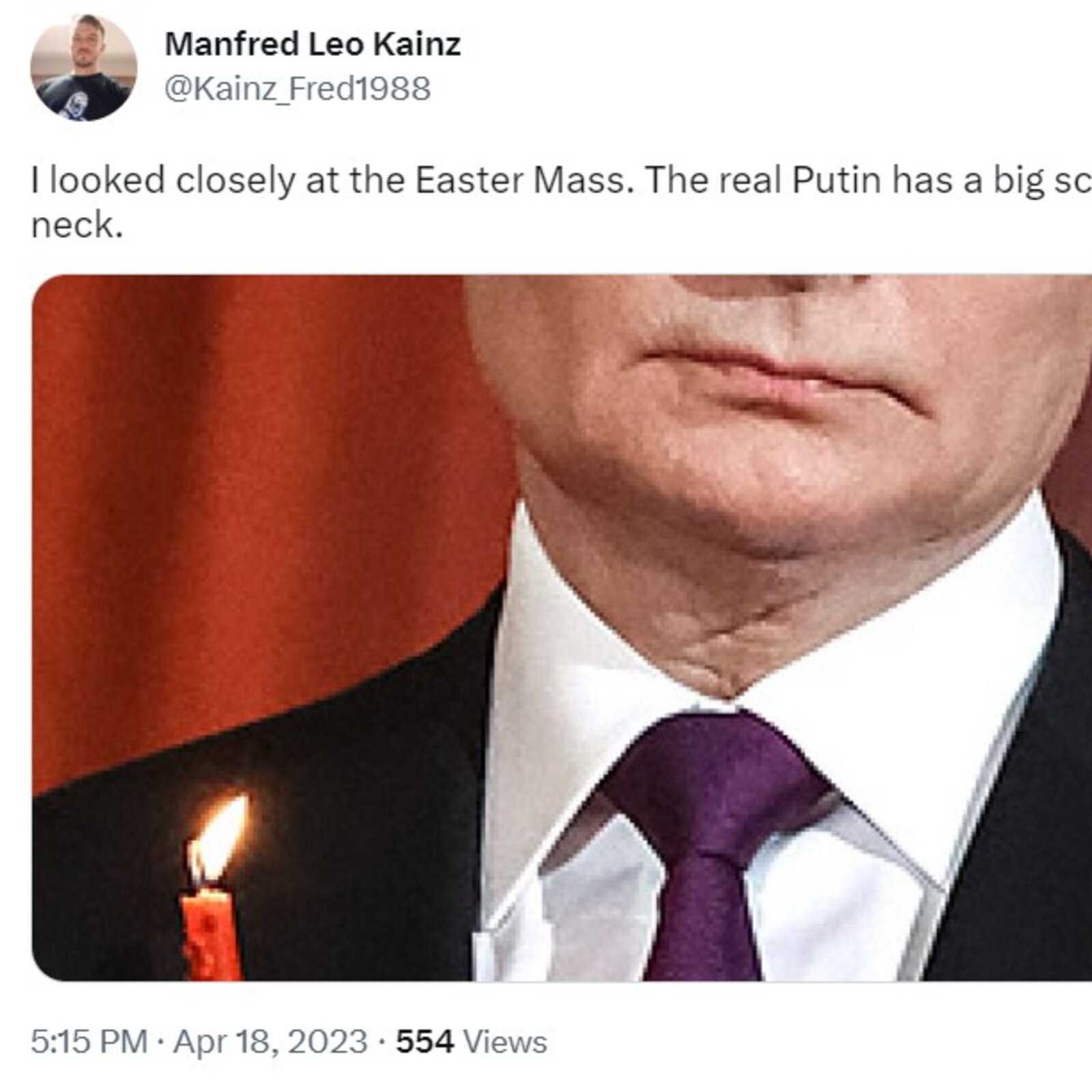 Valami nagyon szokatlant fedeztek fel Putyin nyakán | Nap Híre