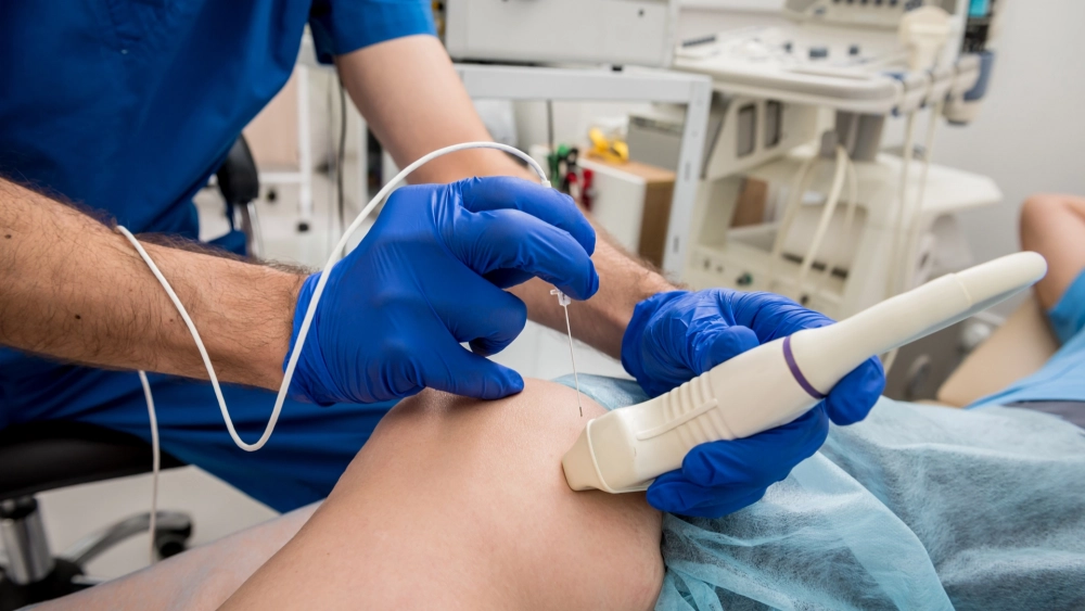 การรักษาโรคหัวใจเต้นผิดจังหวะด้วย EPS WITH RFA คืออะไร