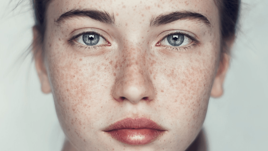 10 Alarming Signs That Say Your Body Is Lacking Iron - Pandorabox