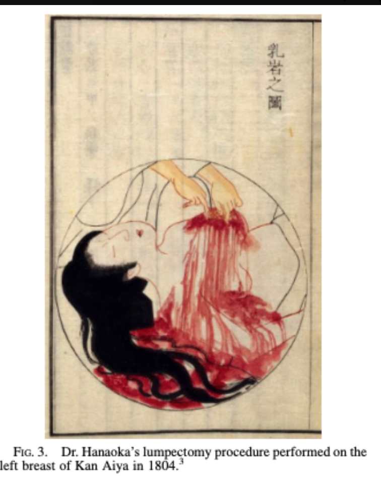 Did You Know? Japan Performed the First General Anesthesia