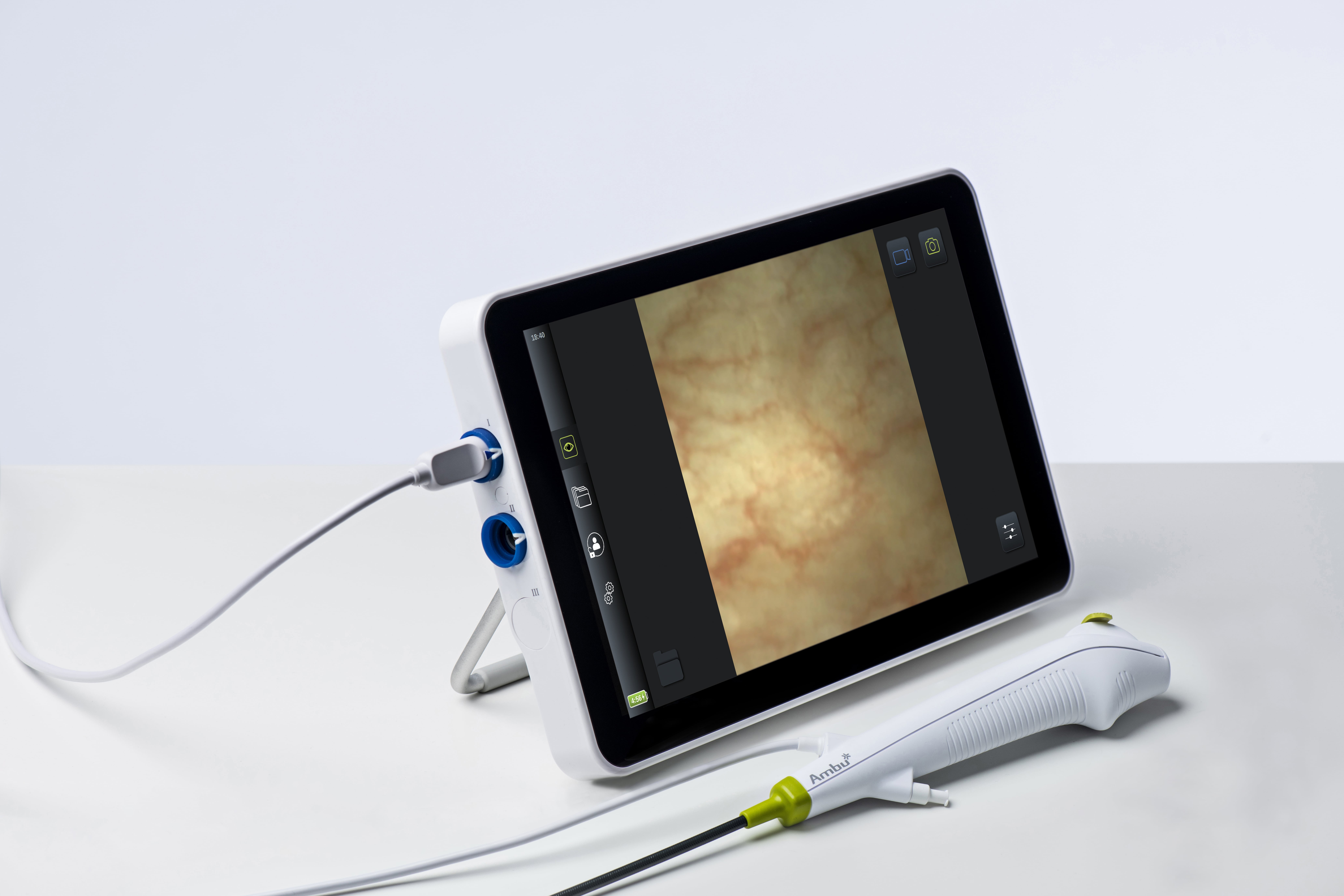 Invivox - Cystoscope à usage unique : une révolution pour l'organisation des activités en urologie