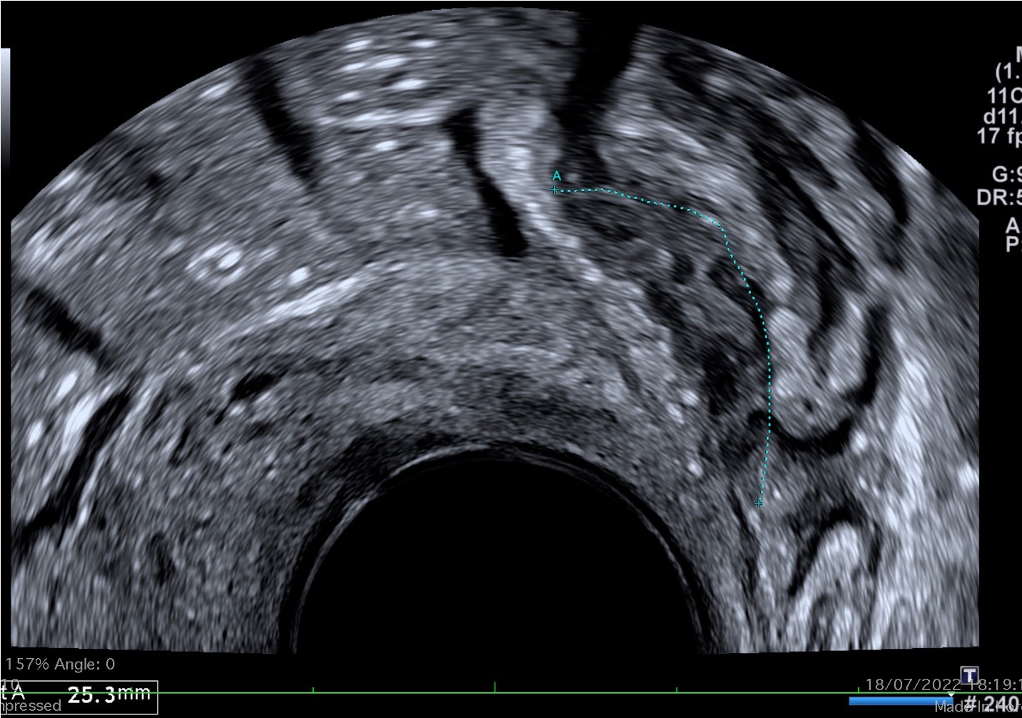 Invivox - Trucs et astuces pour s’améliorer en échographie de l ...