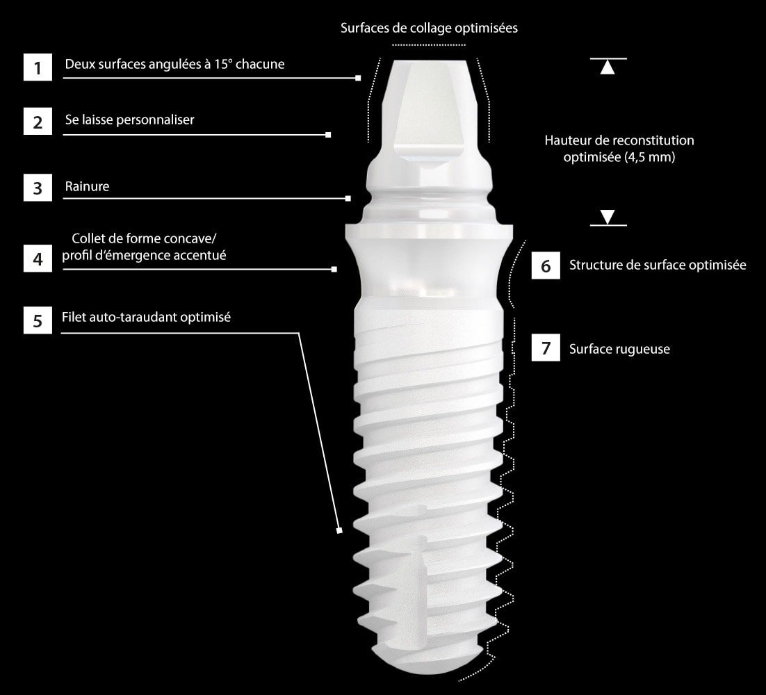 INVIVOX - La pose d'implants en chirurgie guidée dynamique : Extraction ...