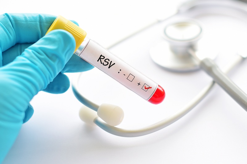 RSV Test Diagnosing Causes of Respiratory Illness