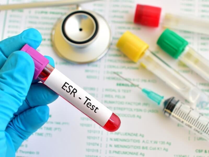 What Does ESR Blood Test Mean 