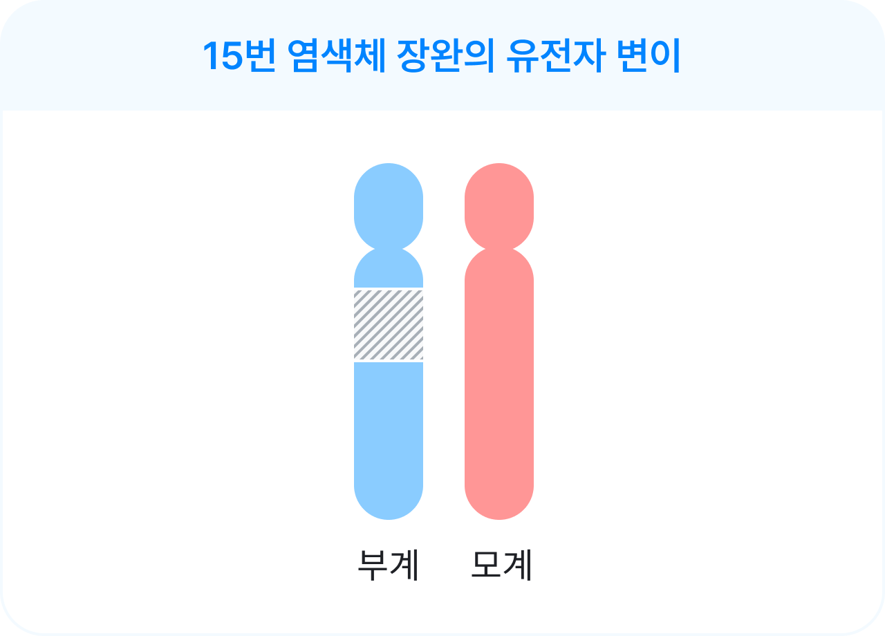 프래더-윌리 증후군과 유전 | 희귀질환 - 레어노트