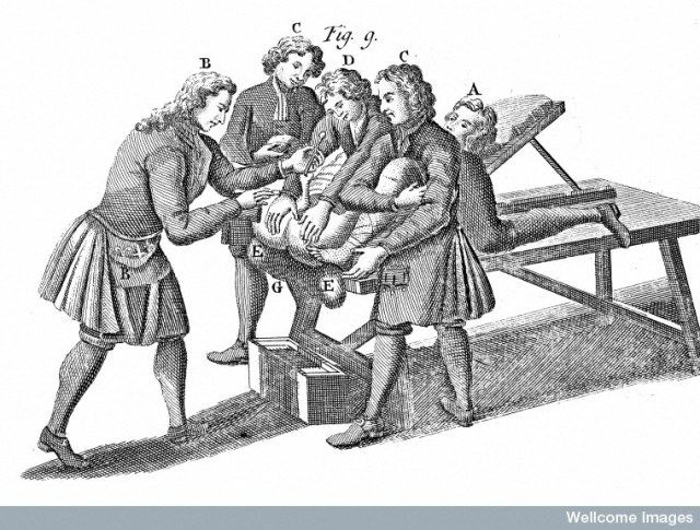TimeOut - The lithotomy position