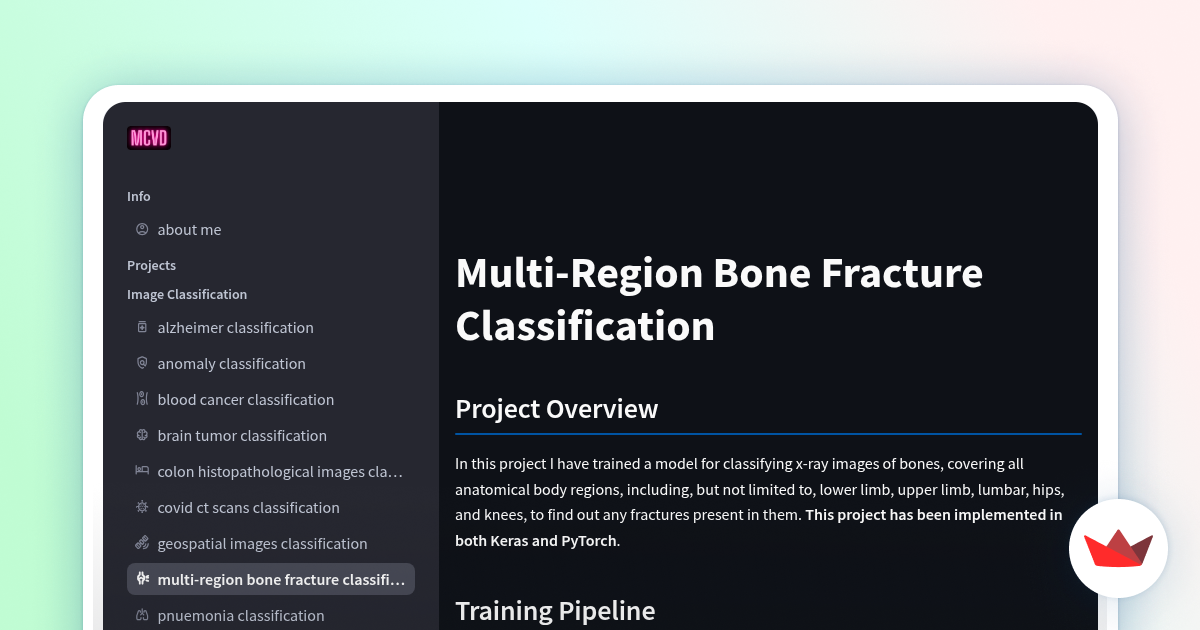 multi-region bone fracture classification