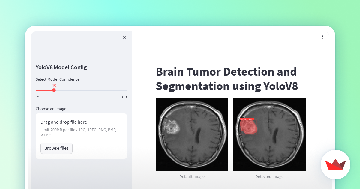 Brain Tumor Detection and Segmentation using YoloV8
