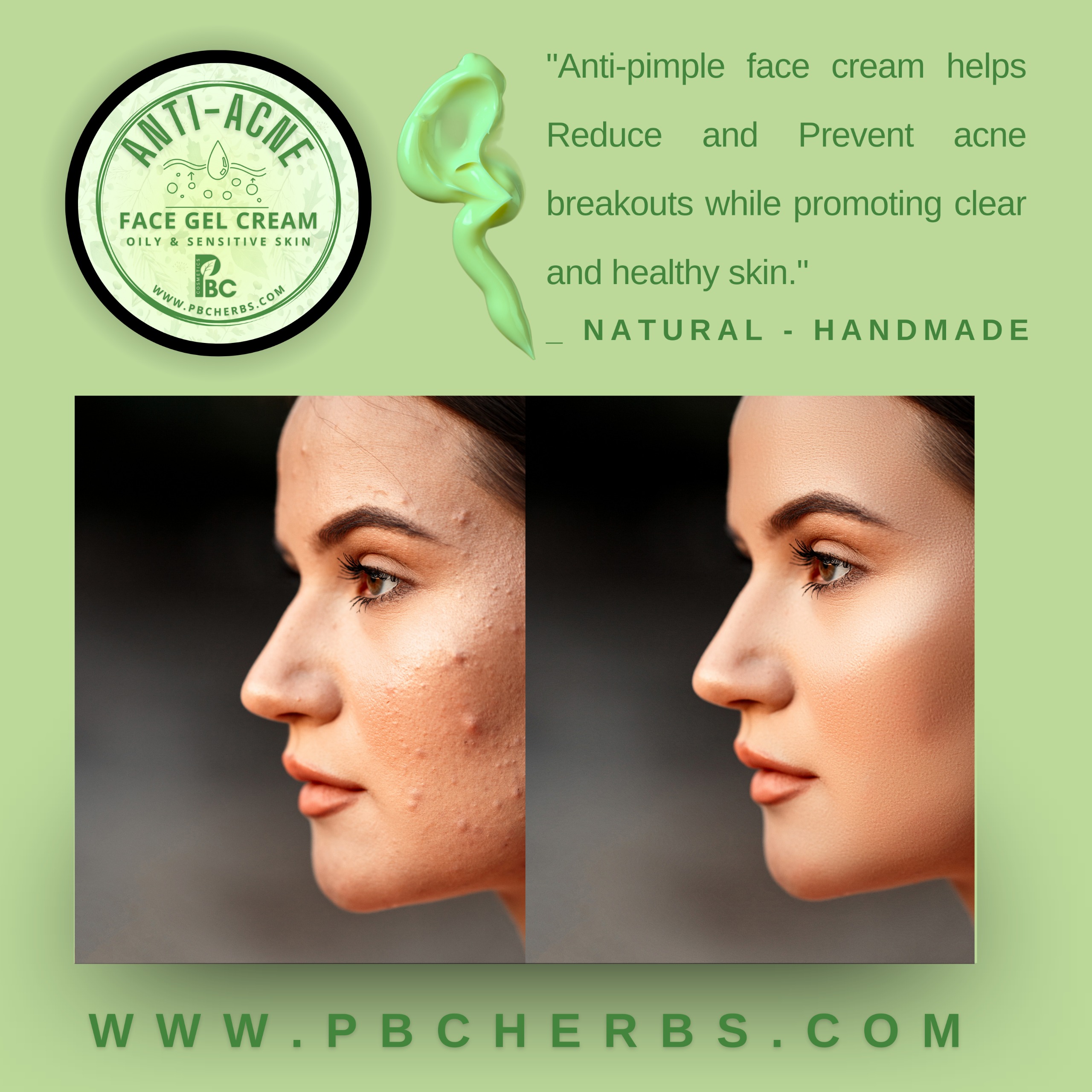 Anti Acne Face Gel Cream
