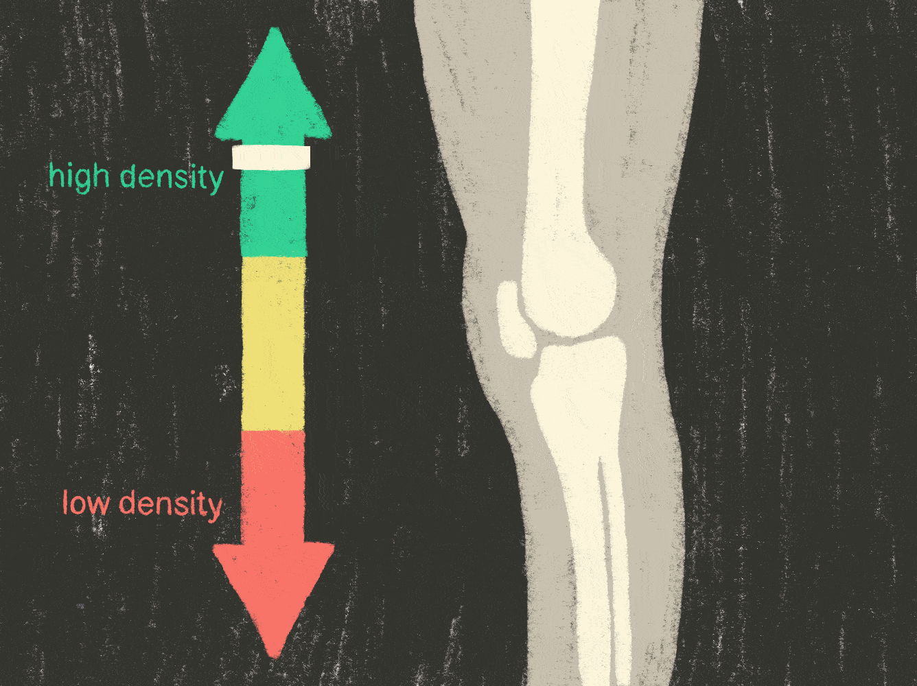 Top 5 Supplements for Better Bone Density | Smarter Reviews