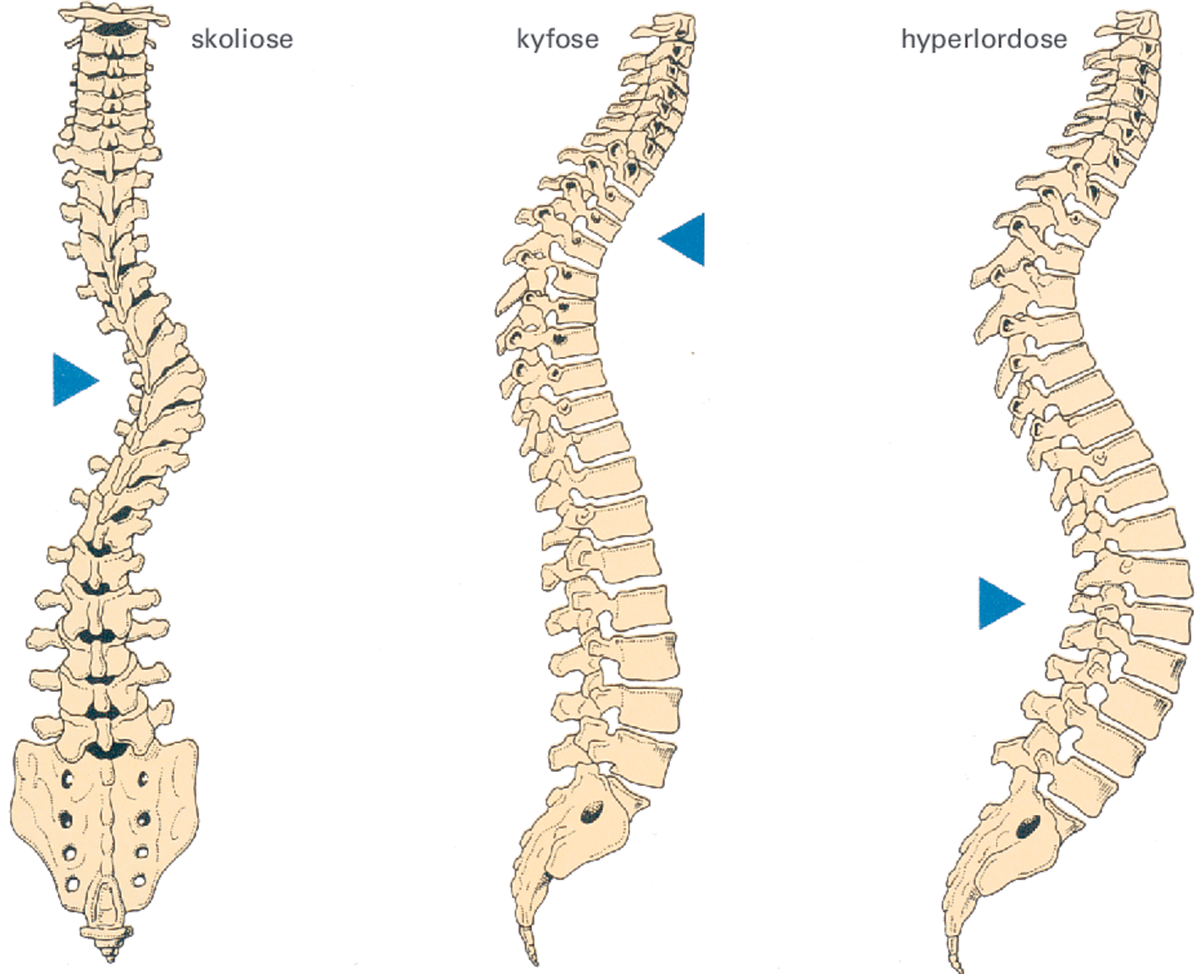 ryggsøylen – Store medisinske leksikon