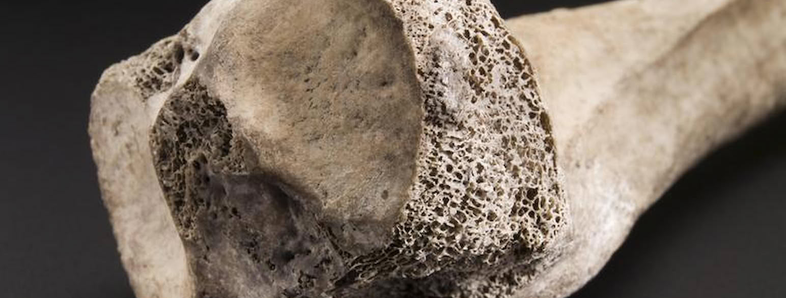 knoklene – Store medisinske leksikon