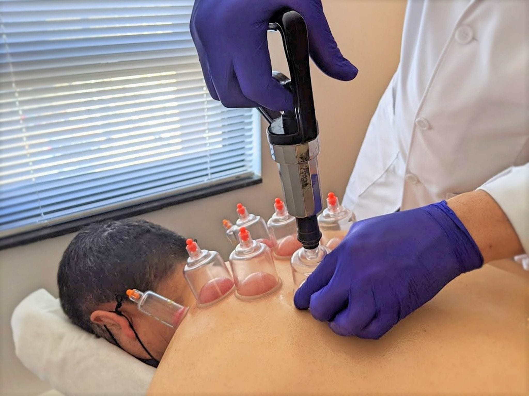 Alexandrians Are De-Stressing with Acupuncture During the Pandemic