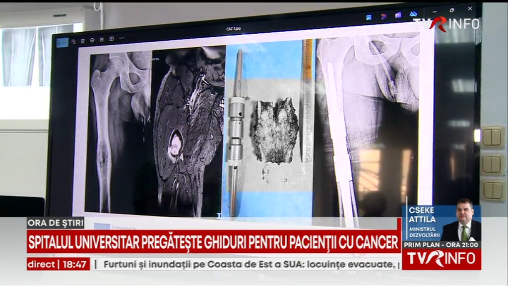 Revoluție în oncologie: Primul program din România pentru tratarea ...