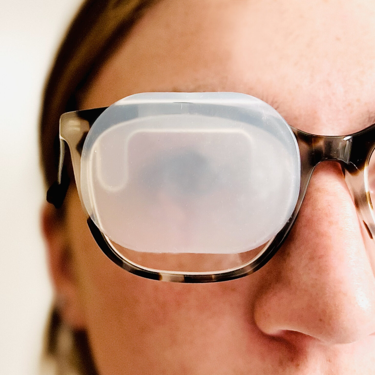 OPTISHIELD Silicone Optical Occluder - Precision Vision