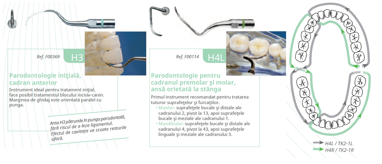 Anse gherute detartraj Satelec Acteon LICHIDARE - Premier Denta