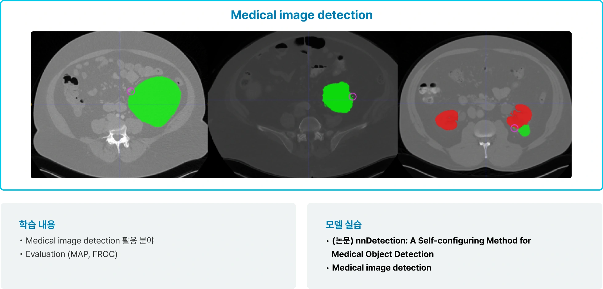 딥러닝을 활용한 의료 영상 처리 And 모델 개발 패스트캠퍼스