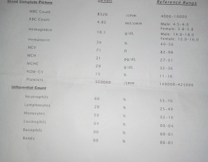 Ask a General Physician Online for Typhoid. Positive