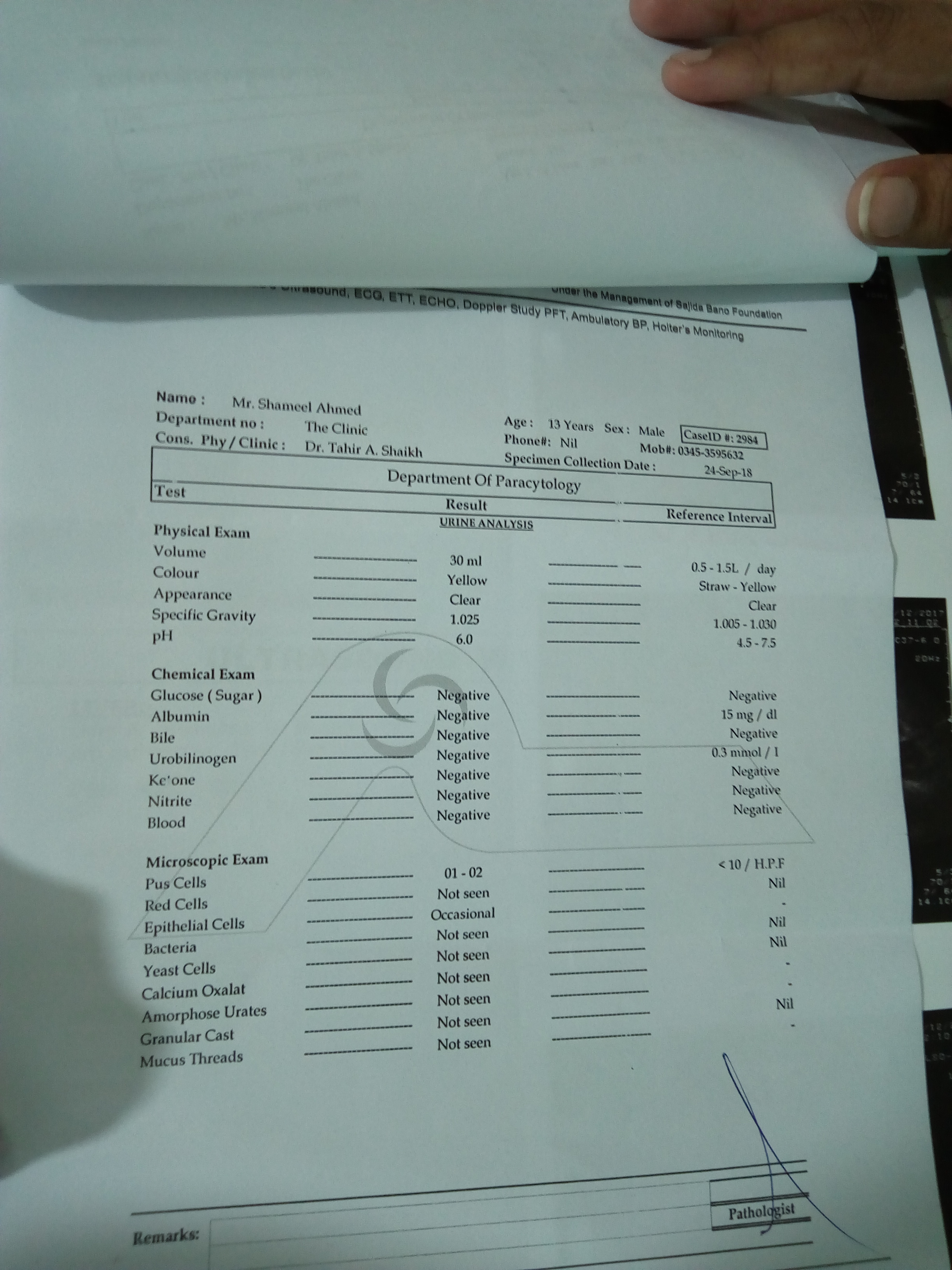 Ask a General Physician Online for Low Platelets Count