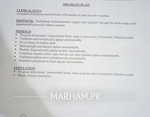 Ask a Neuro Physician Online for Brain Mri Report