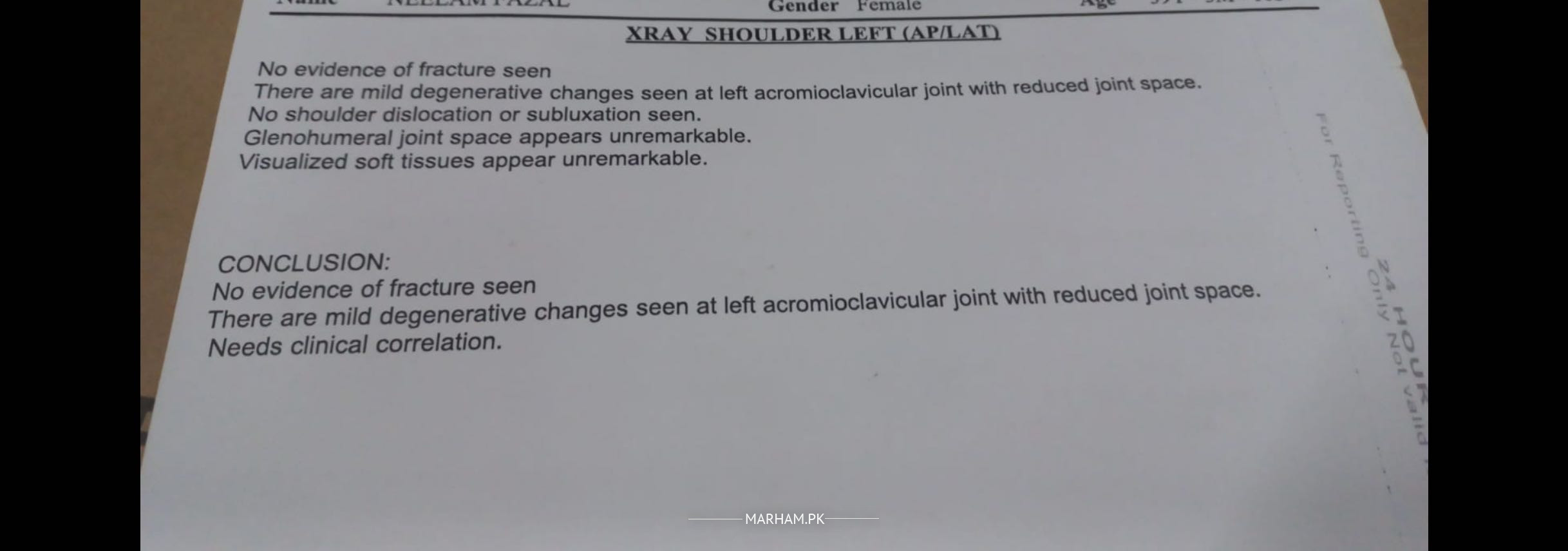 Ask a General Physician Online for Severe Shoulder Pain With Restricted ROM