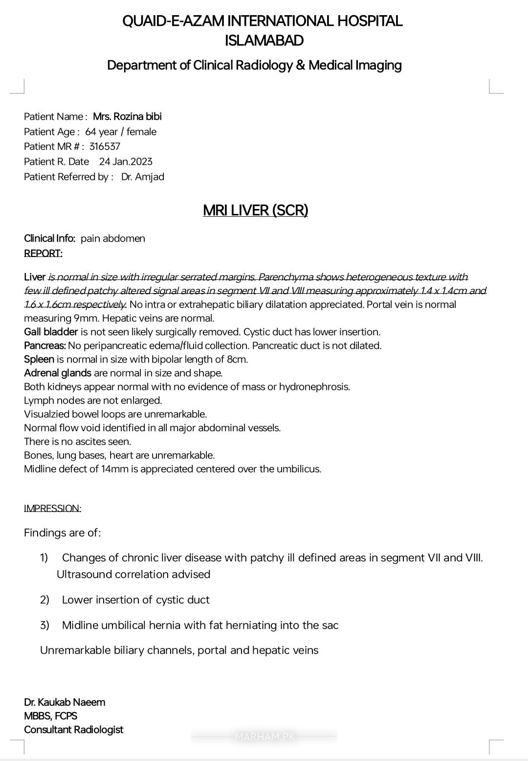 Ask a Gastroenterologist Online for Liver Problem