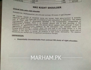 Ask a General Physician Online for Shoulder Pain While Throwing