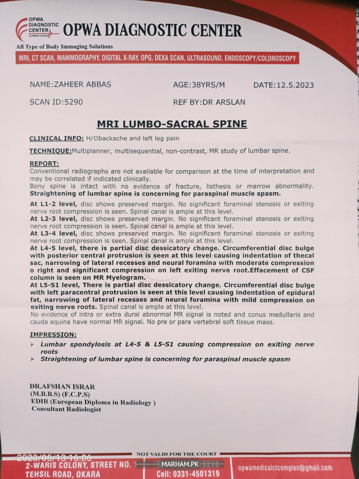 Ask a Cosmetic Surgeon Online for Backache/ Orthopaedic