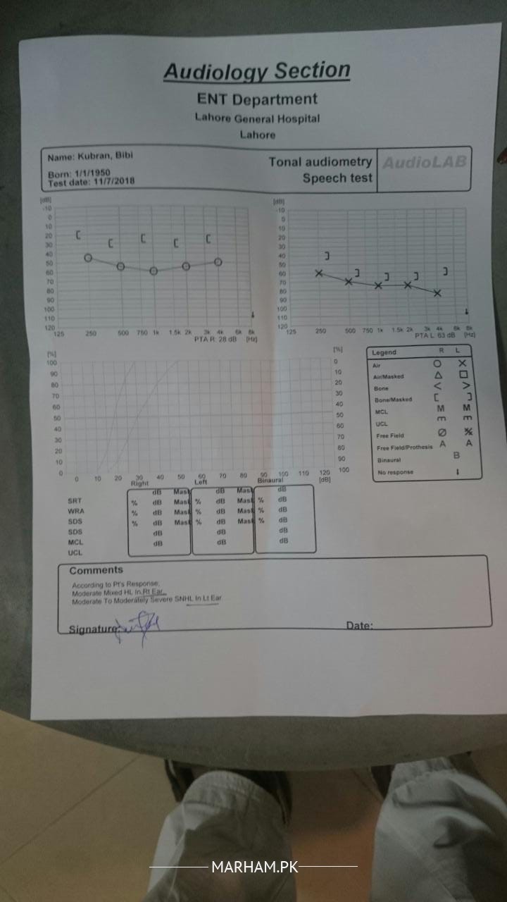 Ask a Ent Specialist Online for Ear (Hearing Problem)