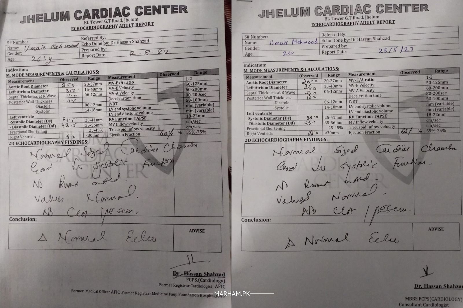 Ask a Cardiologist Online for Echo Reports