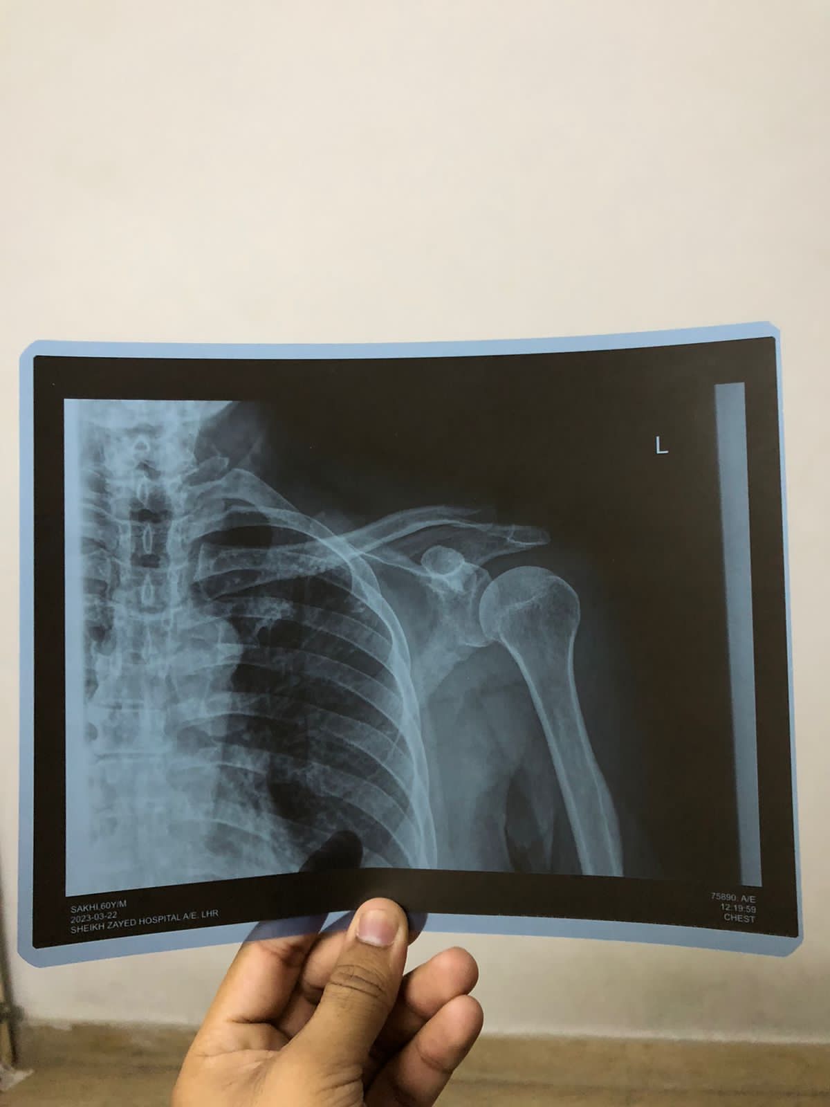 Ask a General Physician Online for Joint Dislocation