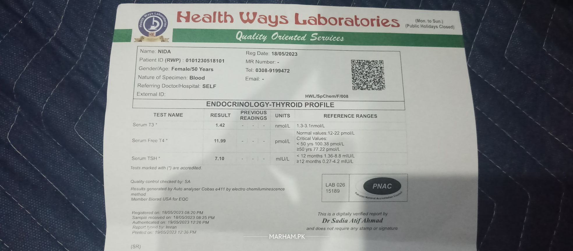 Ask a Endocrinologist Online for Thyroid Profile Report