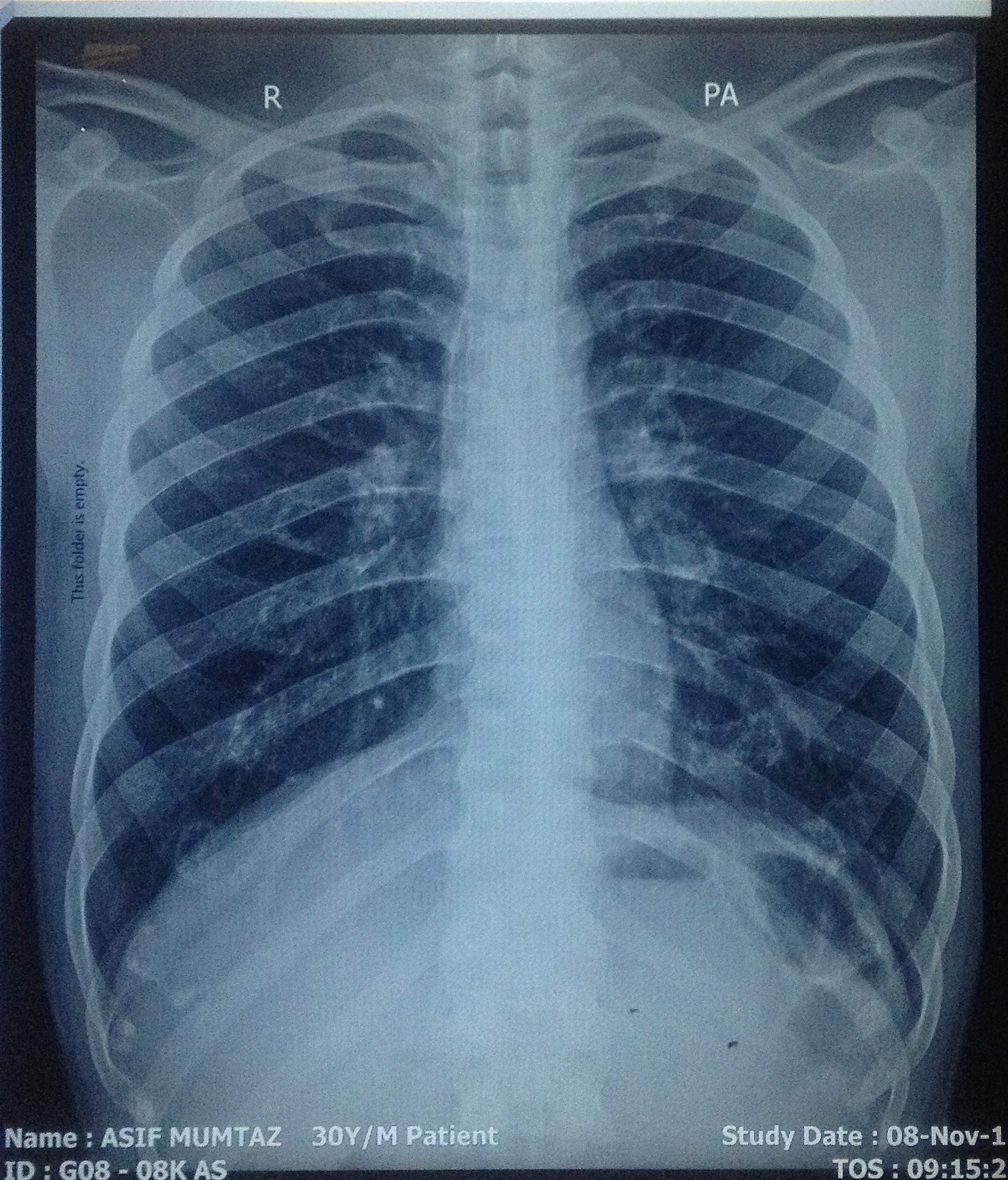 Ask a Radiologist Online for Chest X-ray Analysis