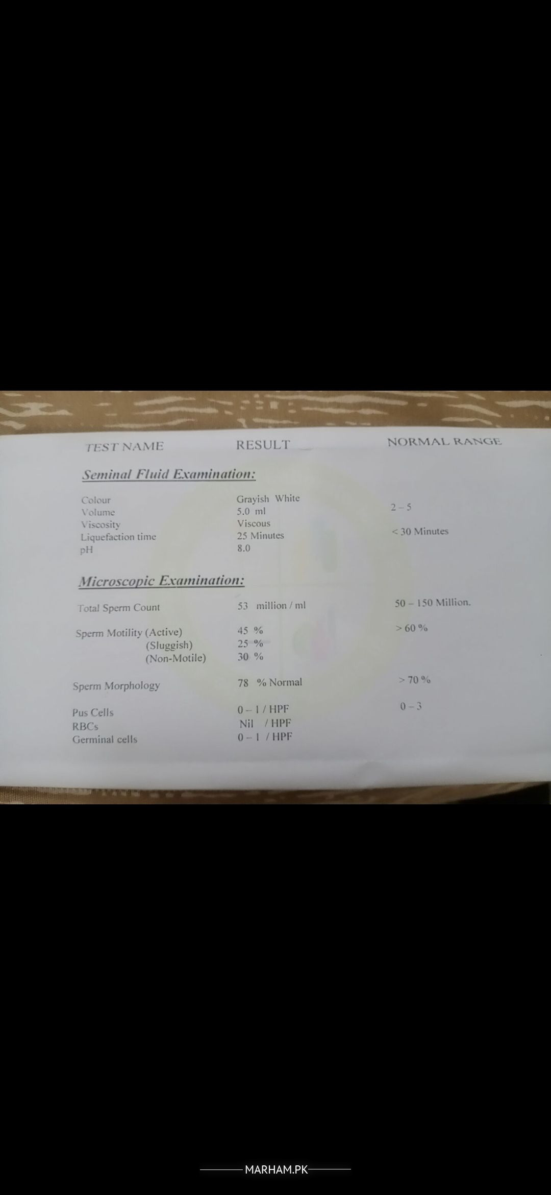 Ask a Urologist Online for Semion Report