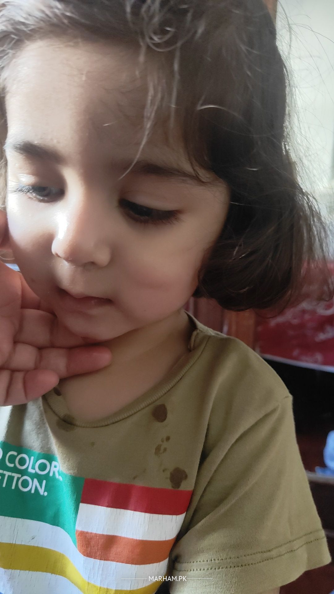 Ask a Dentist Online for Dent On The Cheek