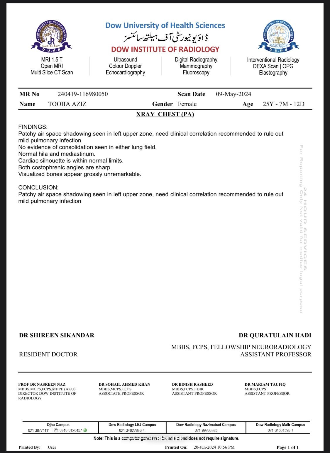 Ask a General Physician Online for Chest X-ray Check