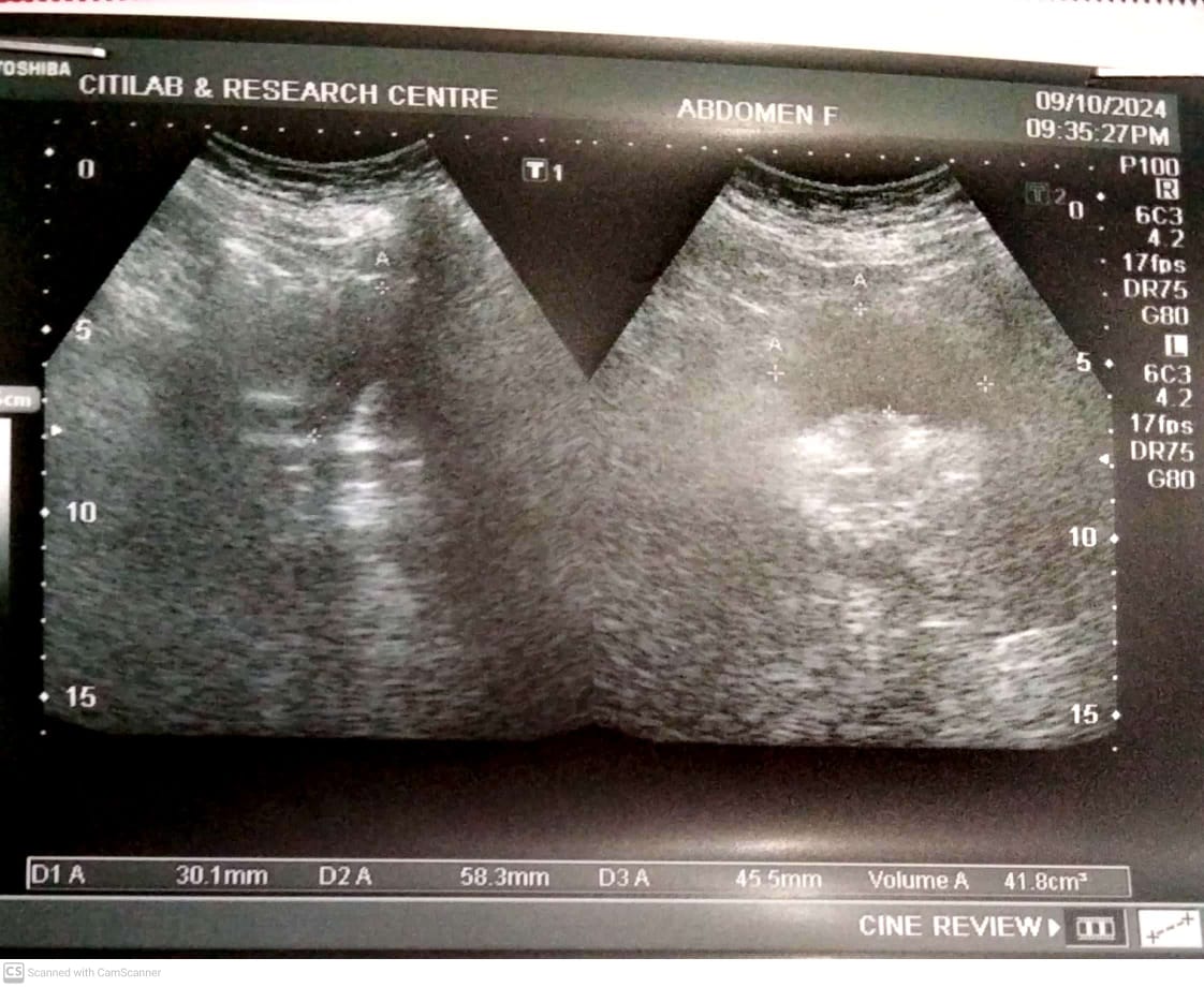 Ask a Gynecologist Online for Utrus Infection