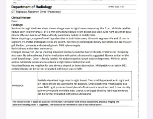 Ask a Cancer Specialist / Oncologist Online for Breast Cyct Diagnose