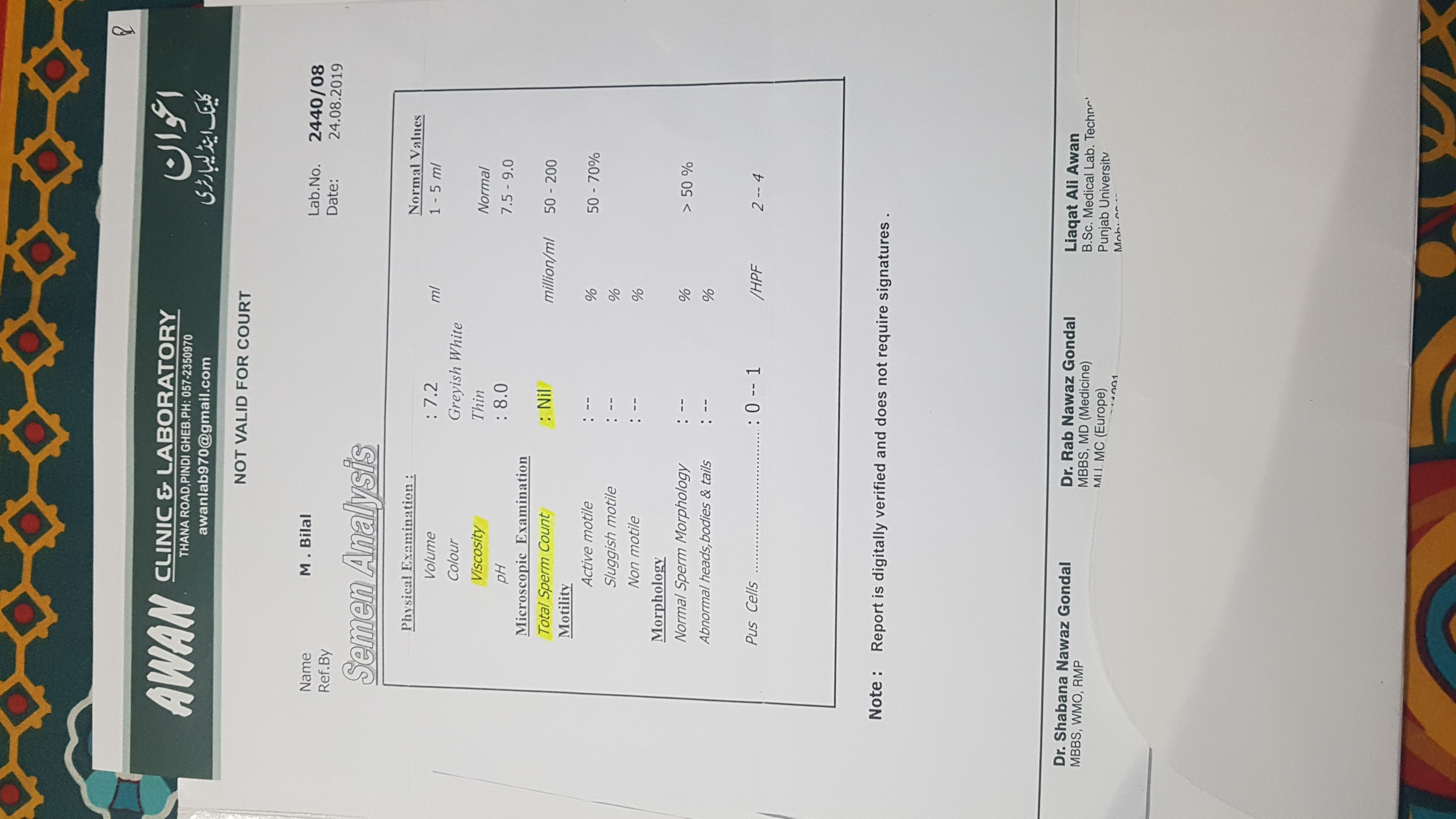 Ask a Urologist Online for Nil Sperm, High FSH And Cyst