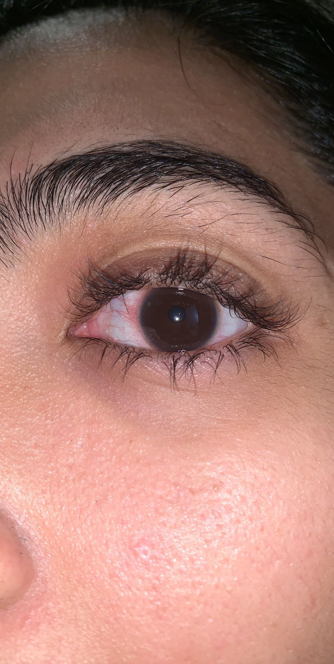 Ask a Eye Specialist Online for Eye Redness