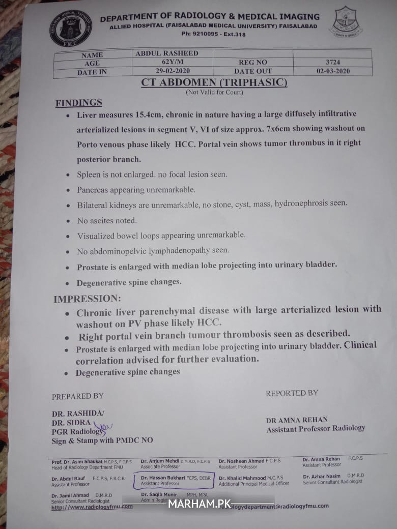 Ask a Cancer Specialist / Oncologist Online for Tumar In CBD