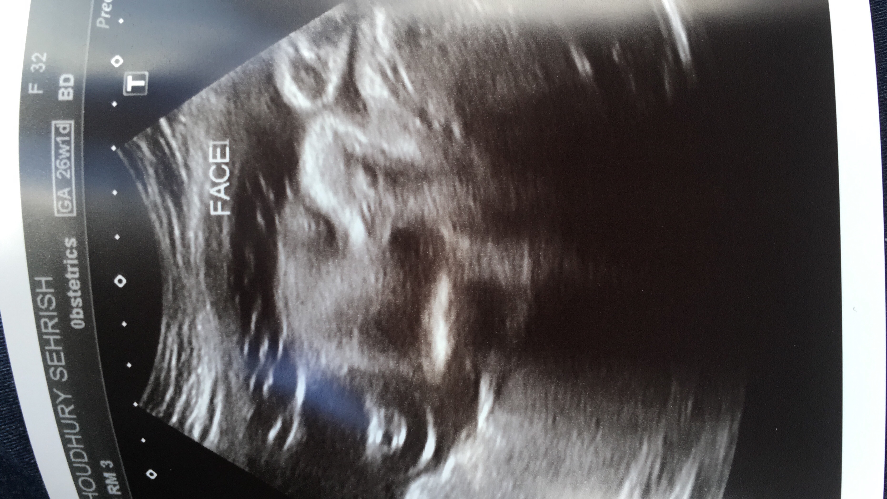 Ask a Gynecologist Online for 26 Week Anatomy Scan