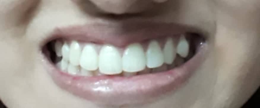 Ask a Dentist Online for Smile Problem