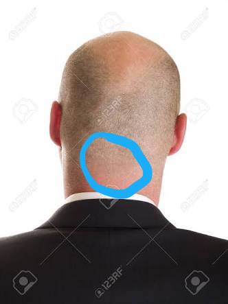 Ask a Ent Specialist Online for Back Of Head