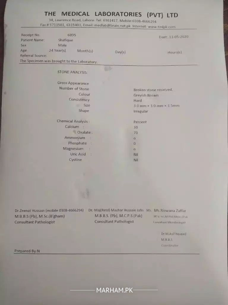 Ask a General Physician Online for Stone Analysis