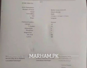 Ask a General Physician Online for Stone Analysis