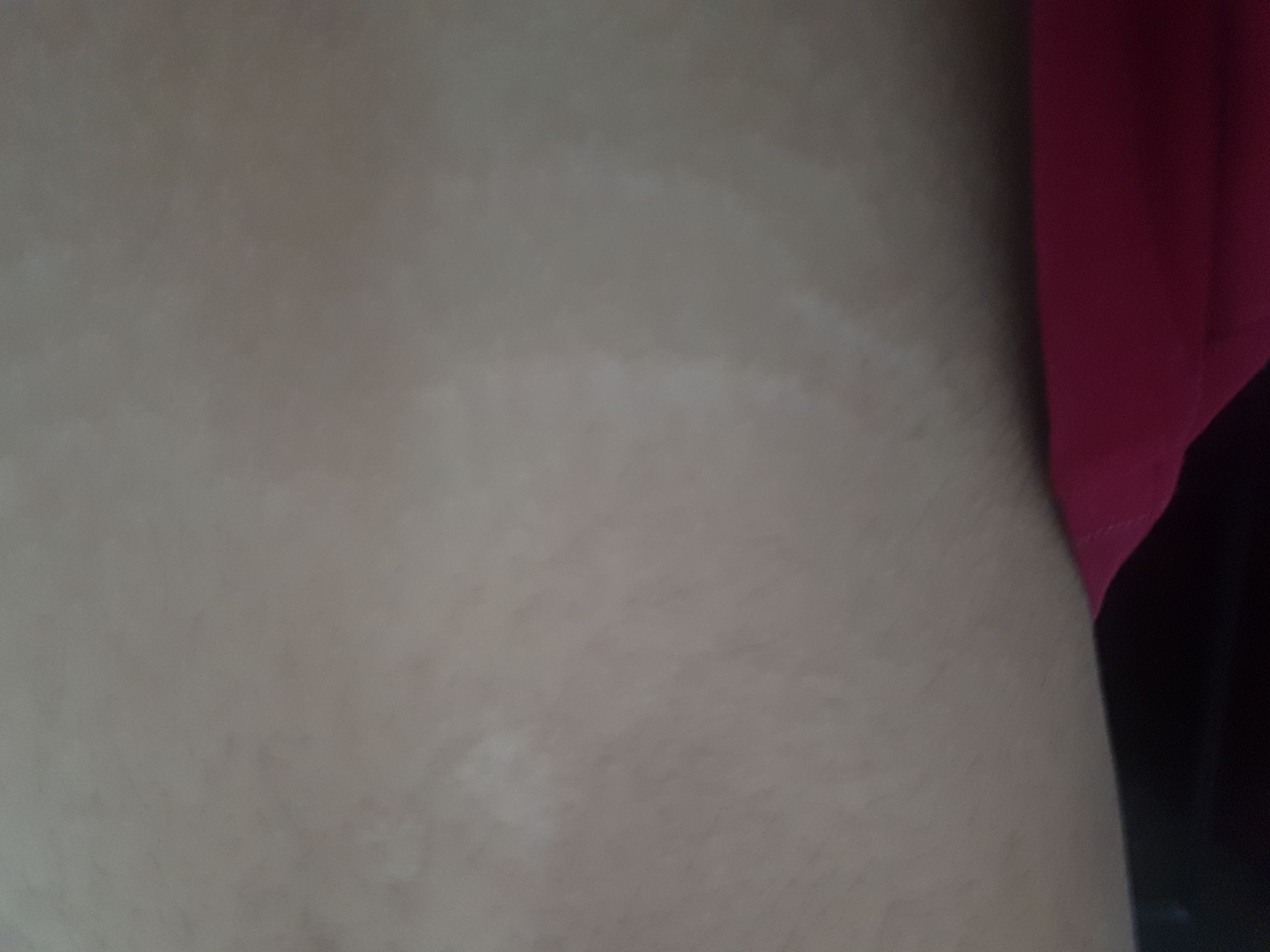 Ask a Dermatologist Online for White Spots And Lines